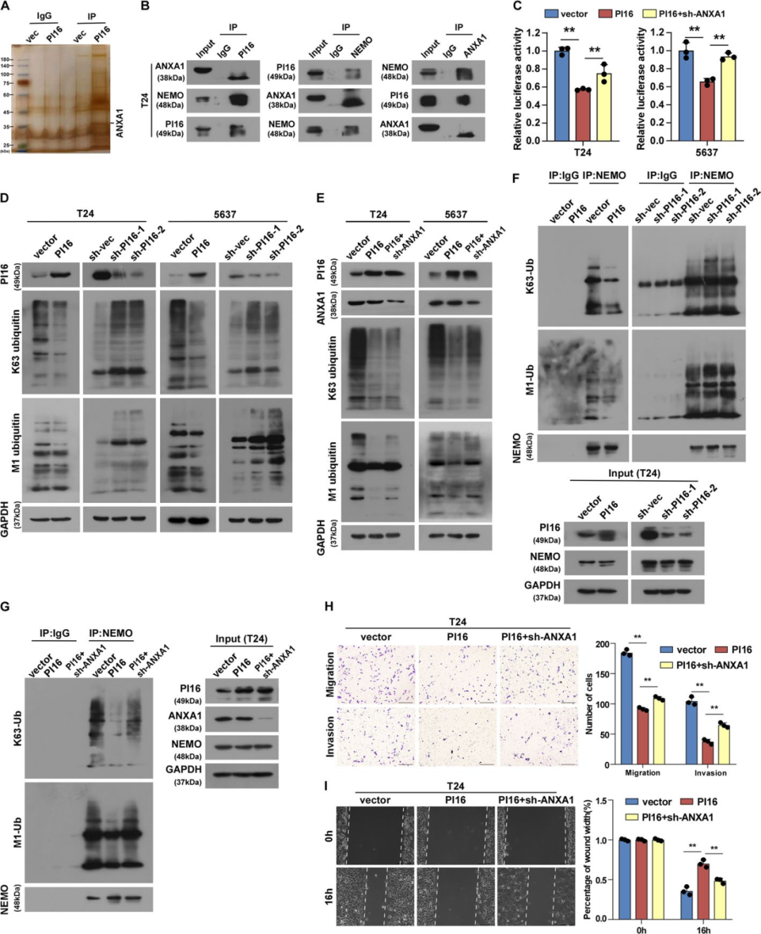 广州医科大学附属肿瘤医院蒋丽丽/杨建安团队揭示PI16在抑制膀胱癌转移中的重要作用 - 知乎