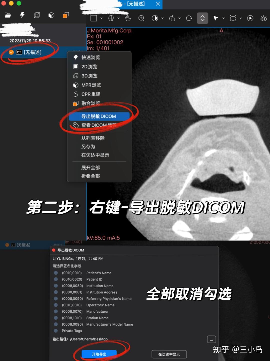 怎么从医院拷贝dicom？医院dcm文件在电脑怎么打开？DICOM 安卓版app？ - 知乎