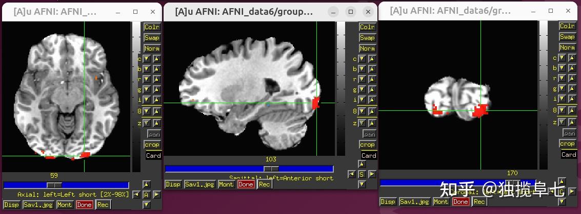 用AFNI处理fMRI数据 - 知乎