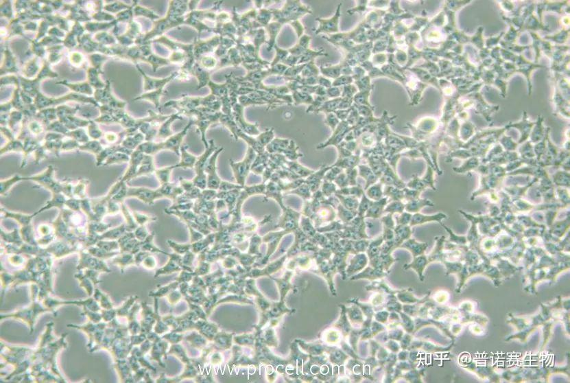 如何让293T贴壁更牢？ - 知乎