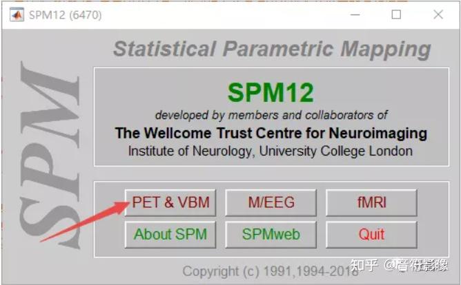 基于SPM的多模态神经影像配准方法 - 知乎