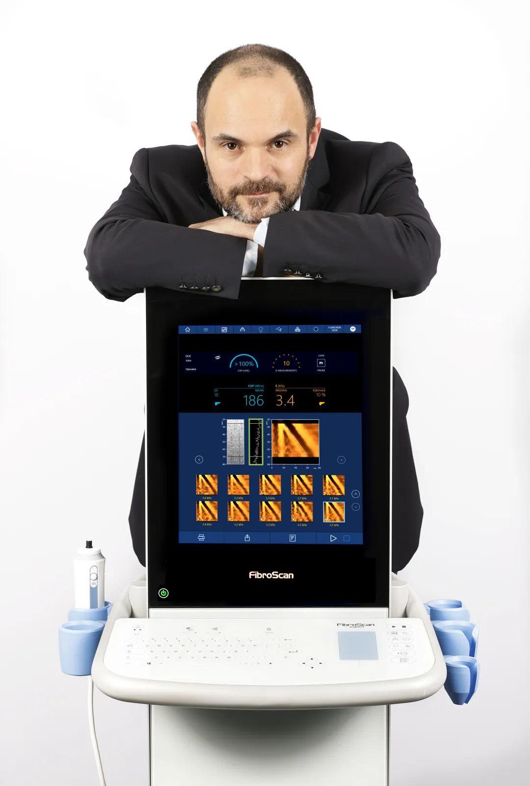 不是所有的瞬时弹性成像技术都叫FibroScan® - 知乎