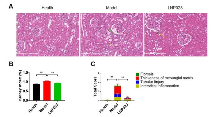 世界肾脏日 |聚焦自身免疫肾病药物的研发挑战与应对策略 - 知乎