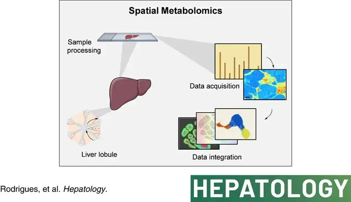 Hepatology丨（IF=12.9）空间代谢组学在肝脏中的应用 - 知乎