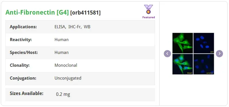 纤连蛋白Fibronectin：细胞外基质的“多维”调控者 - 知乎