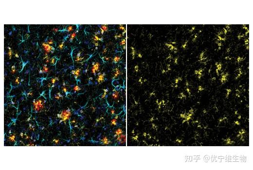 NeuN与MAP2：神经元生物标志物的深度解析 - 知乎