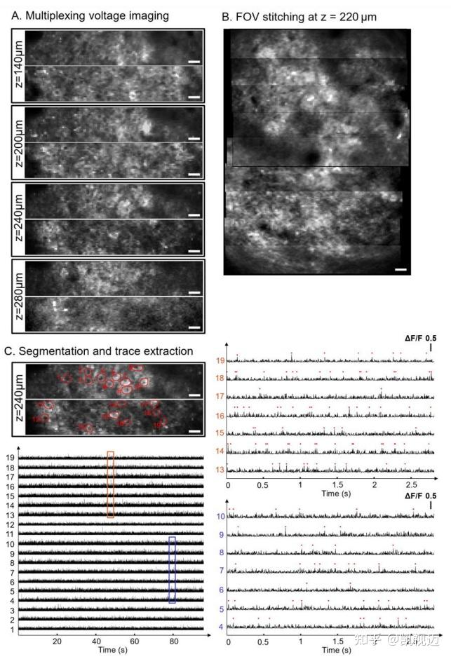双光子显微镜再升级！头戴式微型双光子显微镜的高速电压和钙成像 - 知乎