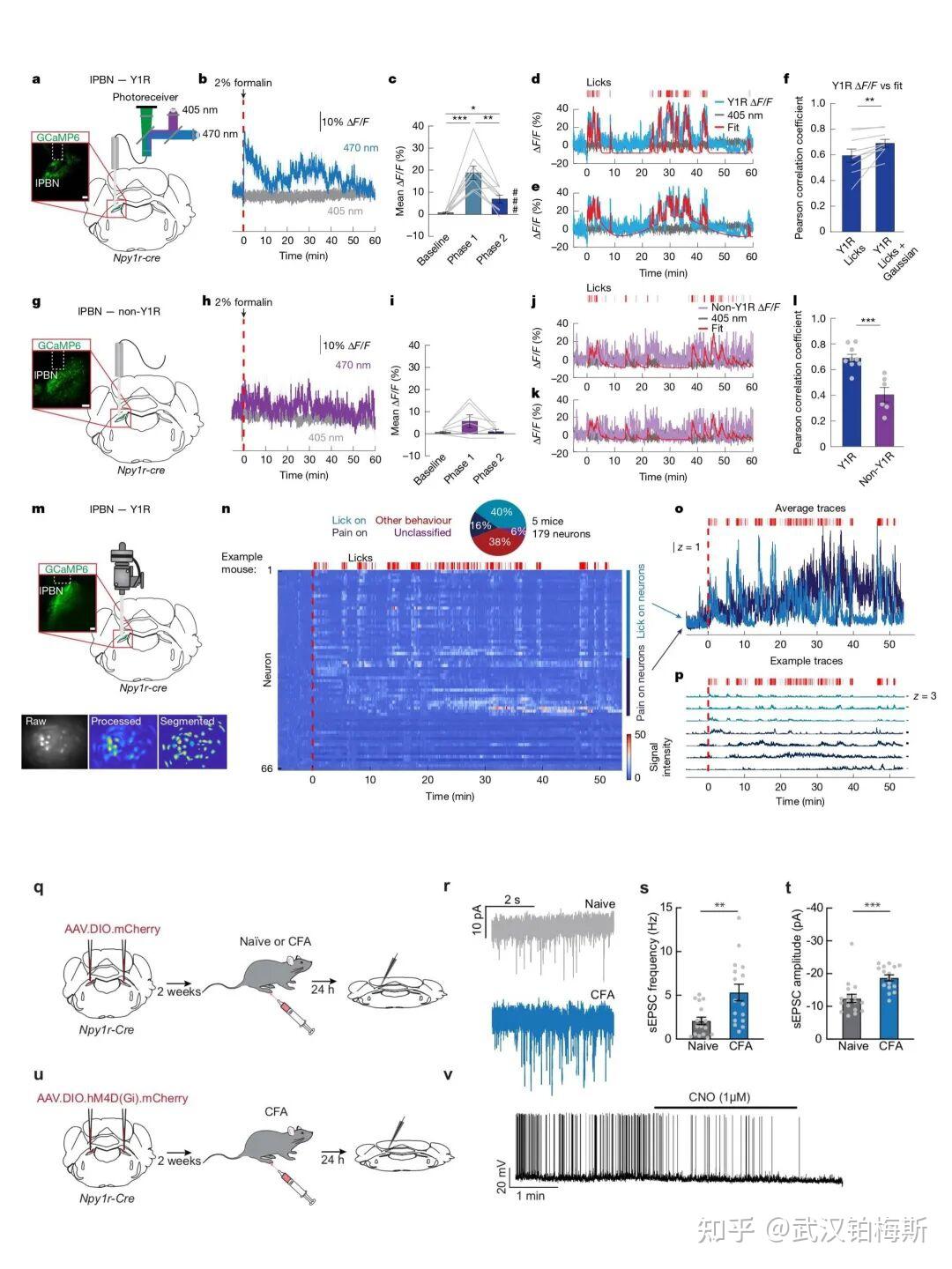 Nature|外侧臂旁核Y1R神经元活性与疼痛状态紧密关联，NPY信号通路为内源性镇痛提供新思路|脑片膜片钳|在体钙成像|行为学 - 知乎