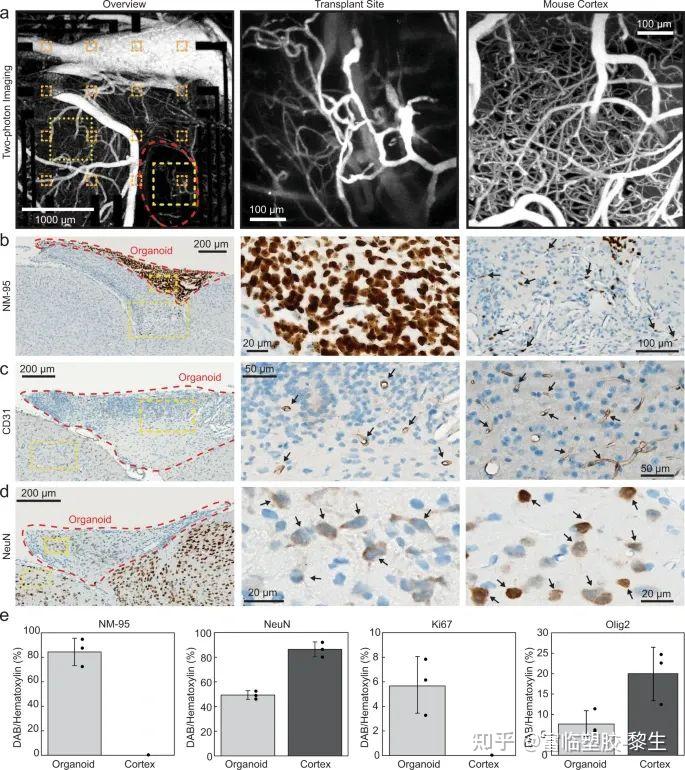将DTA注射到cre小鼠中为什么可以敲除基因呢？ - 知乎