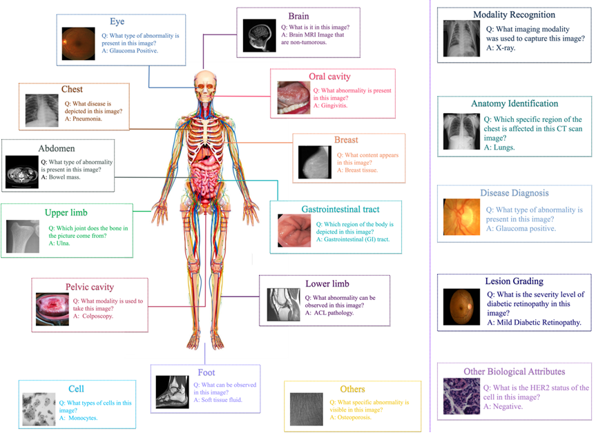 OmniMedVQA：大规模医学VQA评测数据集 - 知乎