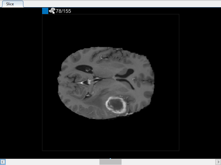 MATLAB图像处理：90：使用 Volume Segmenter 创建二进制蒙版 - 知乎