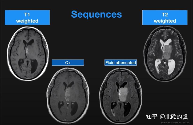 医学影像深度学习系列（六）- 了解MRI（上）-多通道3D图像 - 知乎