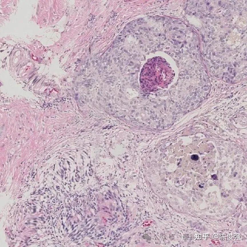 BCI2022——乳腺癌免疫组织化学图像生成挑战 - 知乎