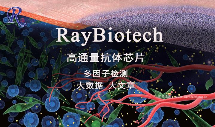 RayBio助力科研机构开发促皮肤伤口愈合新材料|Advanced Healthcare Materials（IF:11.092） - 知乎