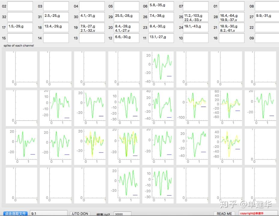 Spike Sorting在脑神经学研究中有多重要？ - 知乎