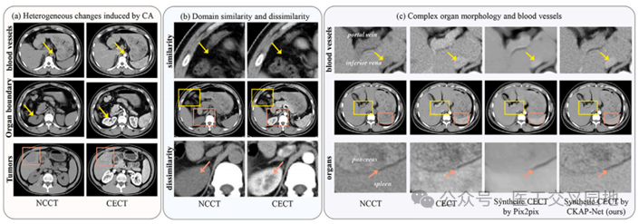 南方医科大学的杨魏团队提出NCCT合成CECT与对比度增强知识和解剖感知在非对比CT图像中进行多器官分割 - 知乎