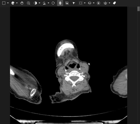 带你认识DICOM - 知乎