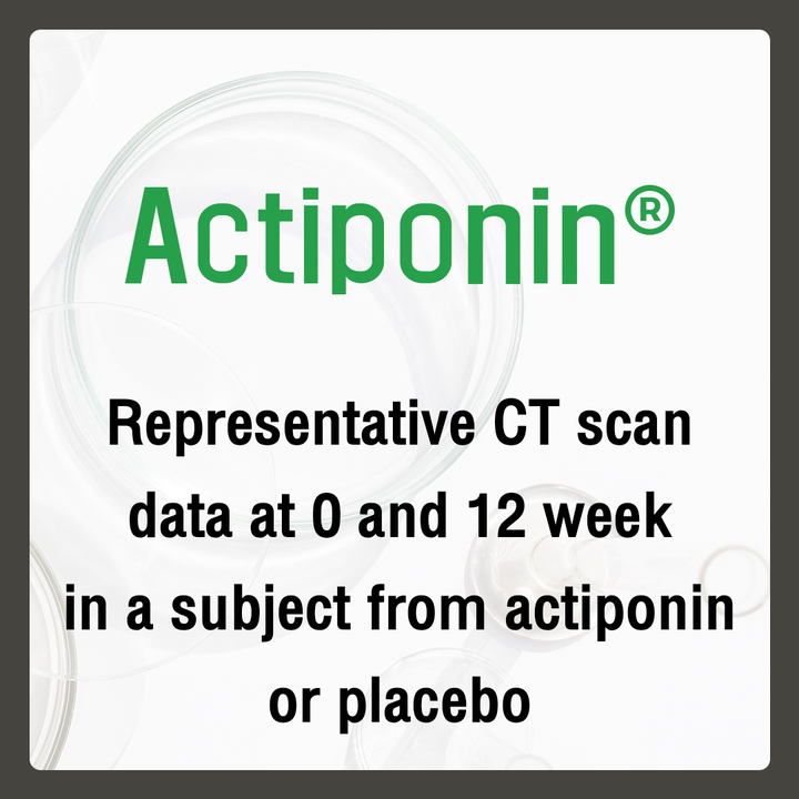 终极绞股蓝 | SBC®推出Actiponin®绞股蓝人类临床实验数据 - 知乎
