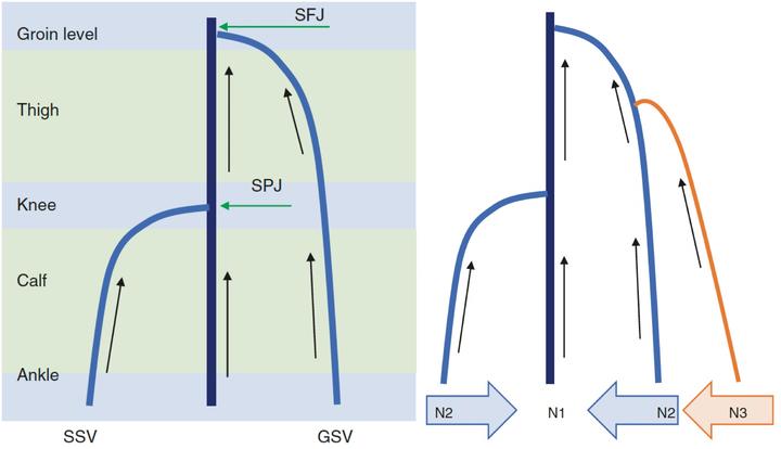 CHIVA语言中的Shunt概念与分类 - 知乎
