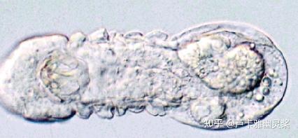 ABOUT MICROGNATHOZOA（1） - 知乎