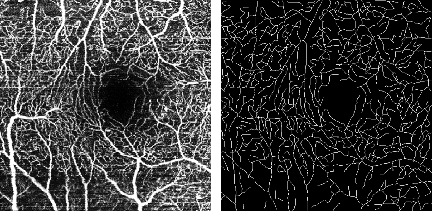 ROSE 数据集介绍 - 知乎