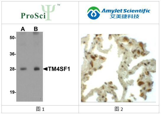 艾美捷ProSci丨ProSci TM4SF1 抗体解决方案 - 知乎