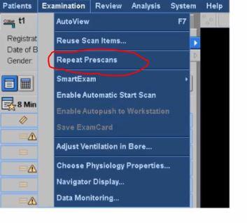 磁共振中非常重要但是又看不到的预扫描Pre-scan - 知乎