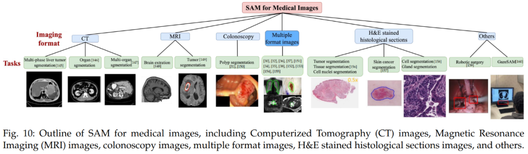 综述：分割一切模型(SAM)的全面调研 - 知乎