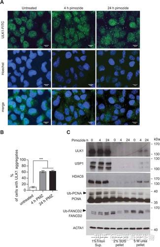 USP1靶向ULK1并调节其细胞区室化和自噬 - 知乎