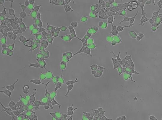 HEK 293细胞培养常见问题及解决办法 - 知乎