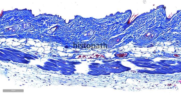 Masson染色原理及实验步骤、结果分析 - 知乎
