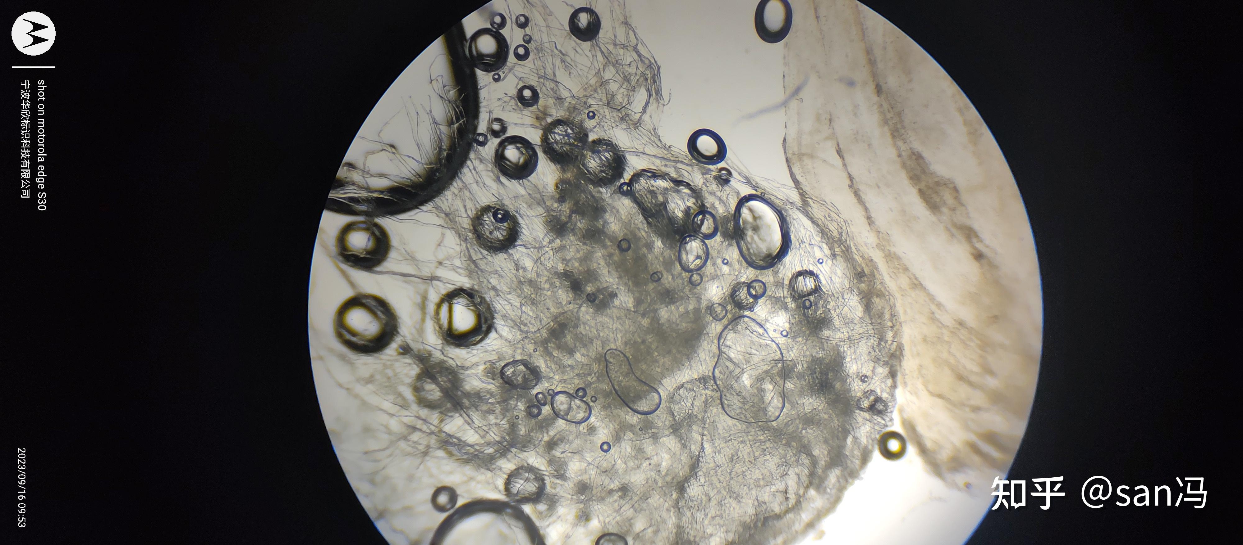 如何区分显微镜下的真菌？ - 知乎