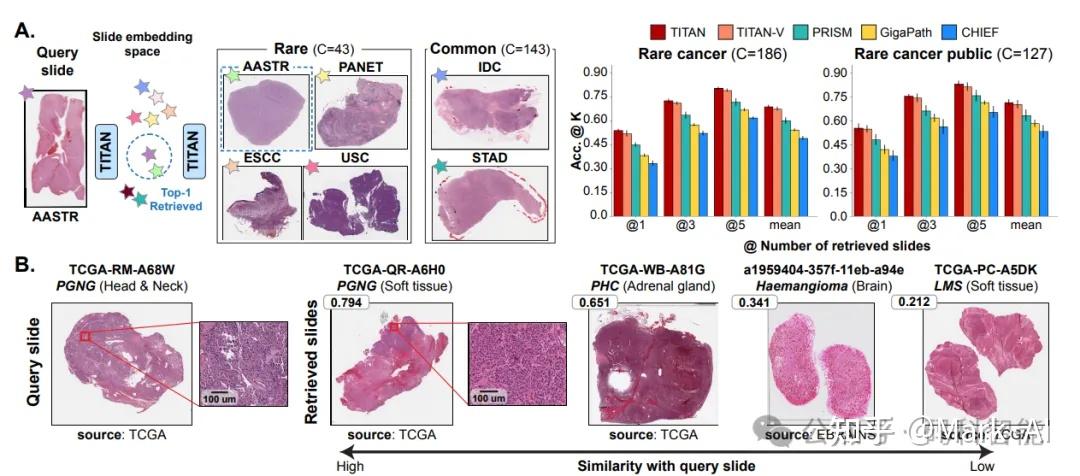 病理大模型四重奏，哈佛医学院全部开源！从UNI、CHIEF到TITAN，从诊断疾病到生成报告，适用30+癌症类型 - 知乎