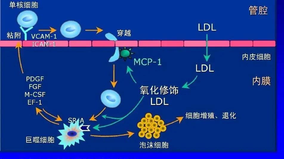 低密度脂蛋白胆固醇（LDL-C）水平过高会对身体产生什么影响？ - 知乎