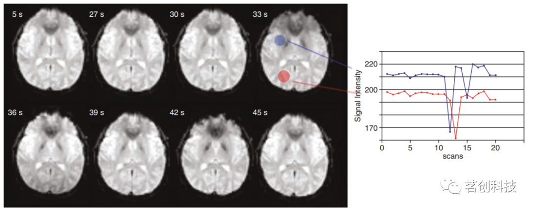 BOLD fMRI和DTI：伪影、技巧和诀窍 - 知乎