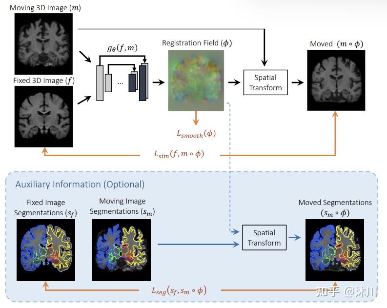 图像配准-VoxelMorph - 知乎