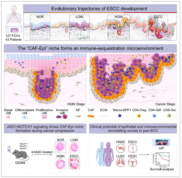 Cancer Cell封面 | 国内首篇Xenium食管癌应用文章亮相 - 知乎