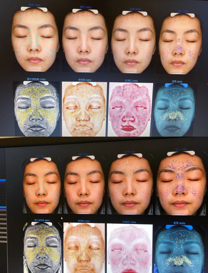为什么医学生建议你选择美白水乳，一定要看持证美白？ 知乎