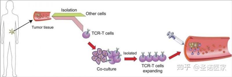 2025年欧洲肝病年会SCG101数据亮眼,TCRT细胞疗法让肝癌、肺癌、肠癌等迎破晓时刻 - 知乎