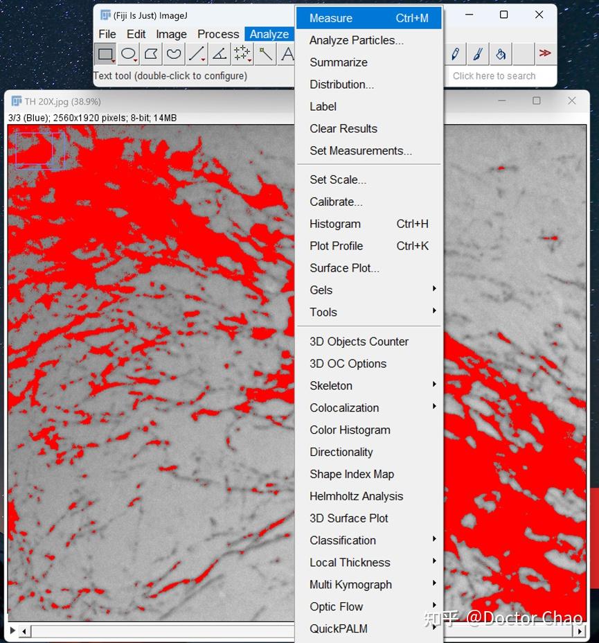 用imagej 免疫组化及荧光强度的分析？ - 知乎