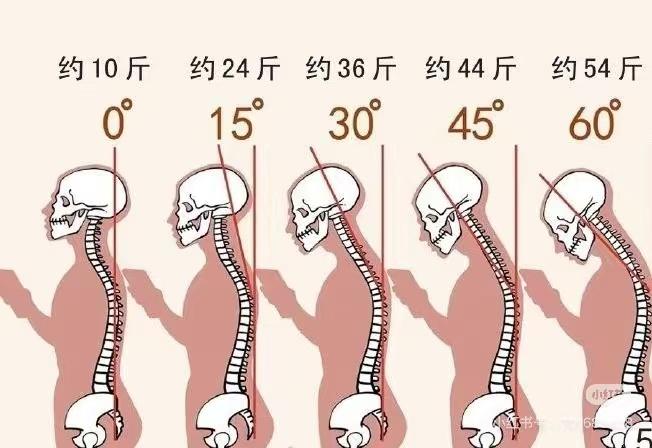 低头45度=颈椎负重22kg！苹果健康团队数据：每天解锁手机时加1个动作，颈椎寿命延长10年！ - 知乎