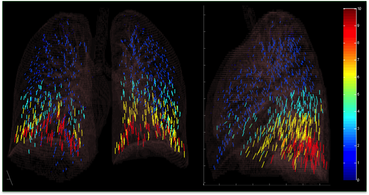 使用 voxelmorph 进行 CT 影像配准——原理和代码实现 - 知乎
