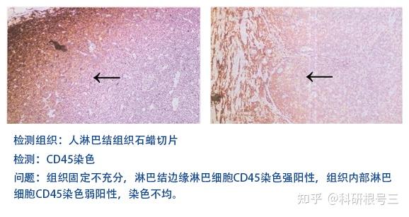 定性、定量、定位，WB、ELISA、IHC 三大免疫学实验，这一篇全搞定！ - 知乎
