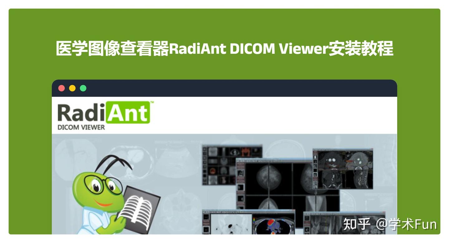 医学图像查看器RadiAnt DICOM Viewer安装教程，附安装包 - 知乎