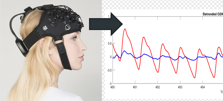 如何评估近红外光谱NIRS信号质量？ - 知乎