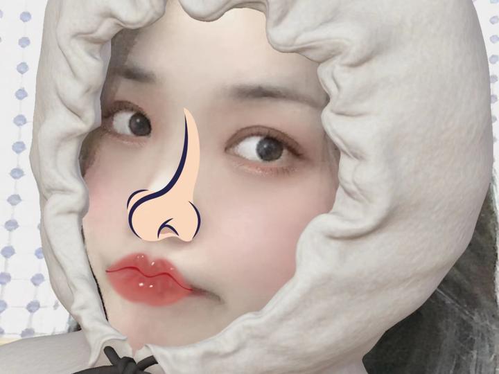 噶双眼皮经历分享~以一己之力希望能帮上集美们~ - 知乎