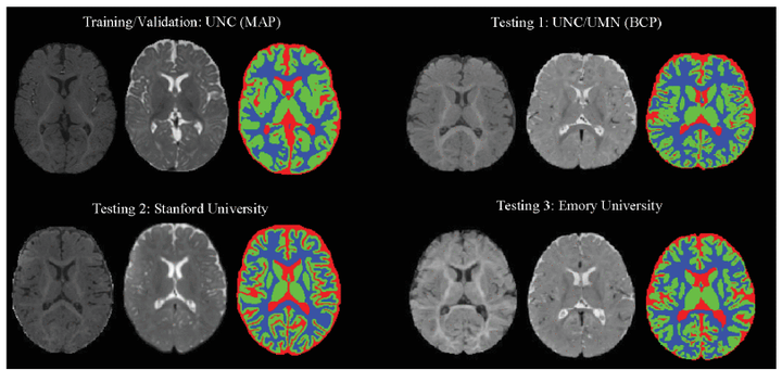 iSeg 数据集介绍 - 知乎