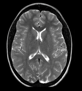 MRI(磁共振成像)空间编码 - 知乎