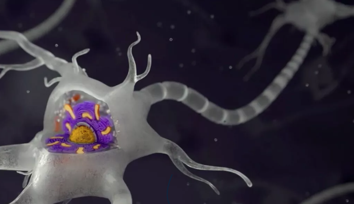 百年顽疾新突破 | 美国FDA批准Relyvrio用于肌萎缩侧索硬化症患者 - 知乎