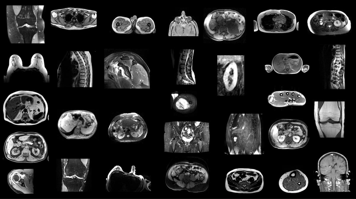 TotalSegmentator MRI dataset 磁共振图像全身 56 种解剖结构分割数据集介绍 - 知乎